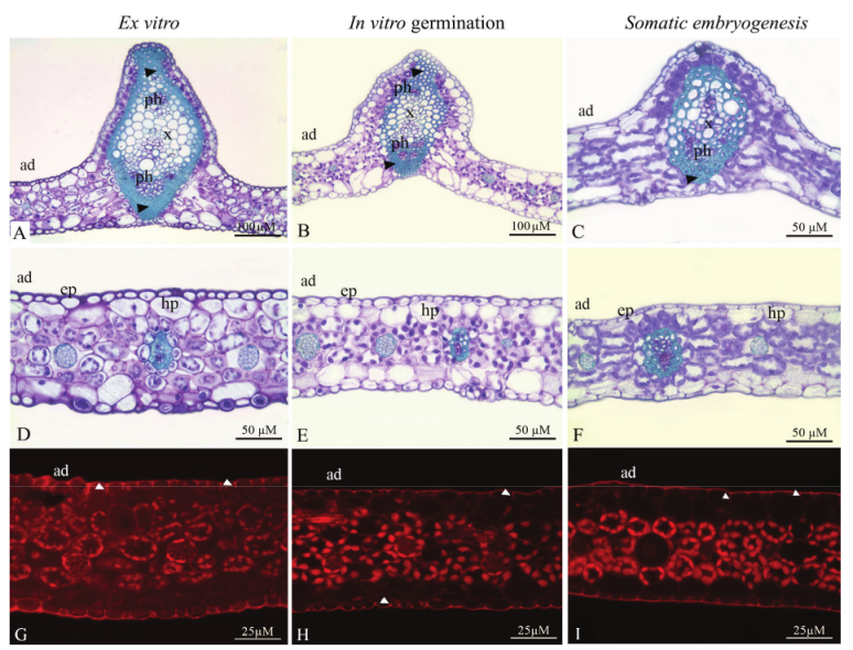 Leaf histology of greenhouse plants, in vitro cultured and somatic ...