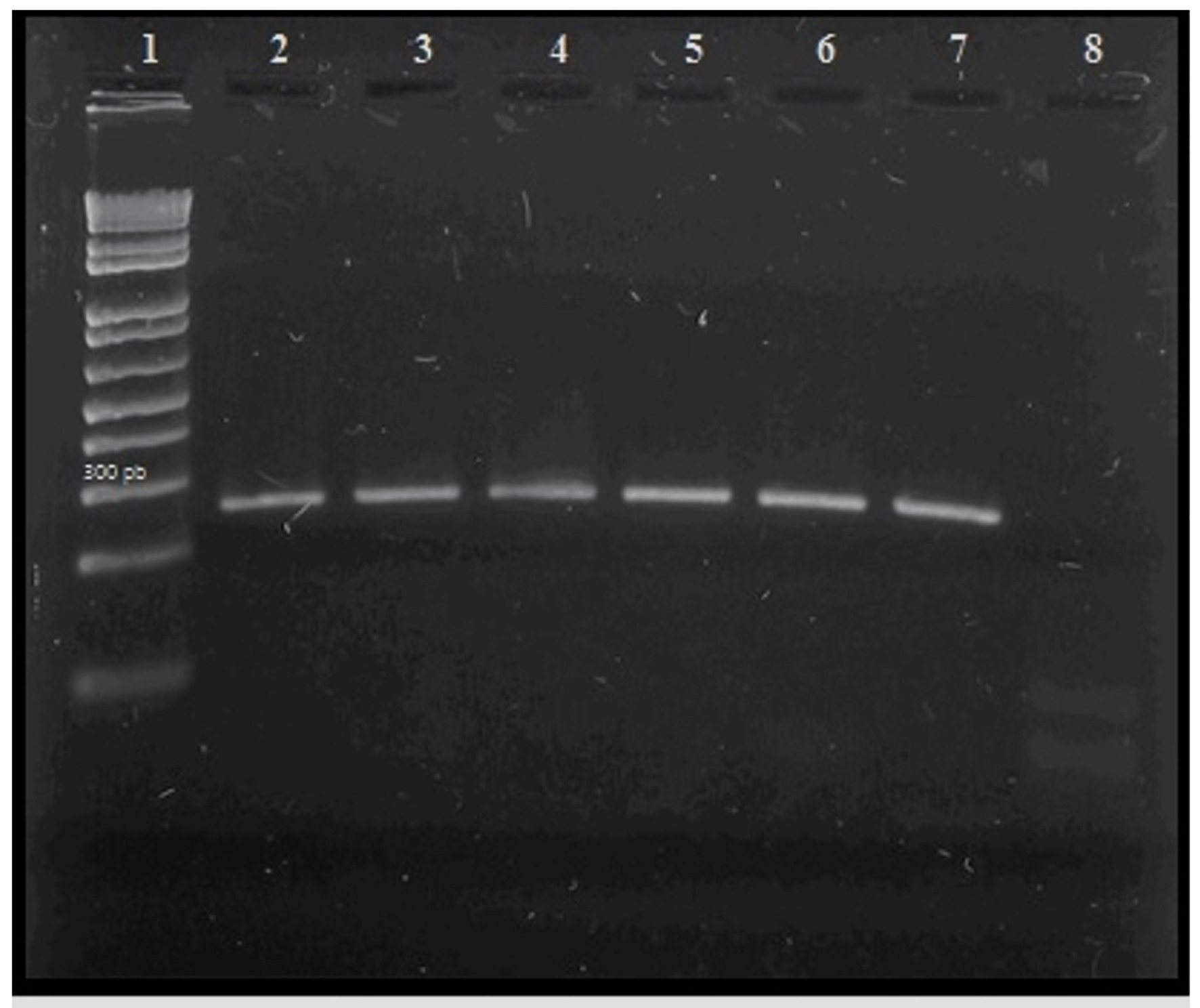 Estudio comparativo del diagnóstico de leptospirosis mediante PCR y MAT ...