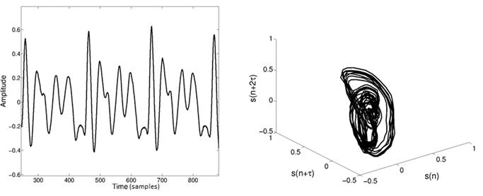 Automatic detection of hypernasal speech of children with cleft lip and ...
