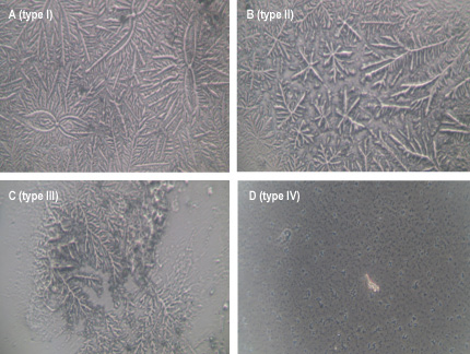 The role of the fern test in the treatment of rhinitis