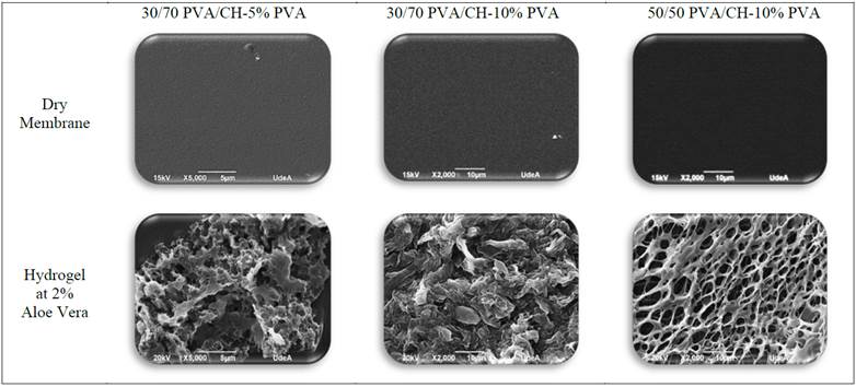 Manufacturing and evaluation of Chitosan, PVA and Aloe Vera hydrogels ...