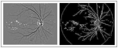 A GPU-based Evolution Strategy for Optic Disk Detection in Retinal Images