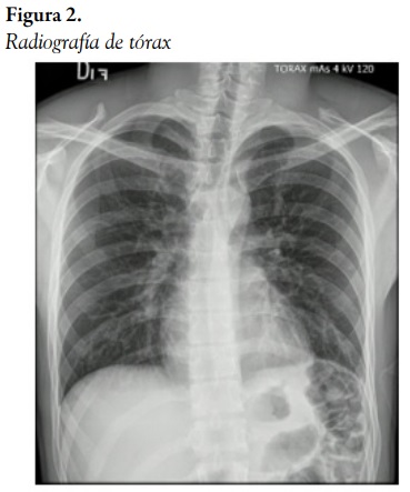 La importancia de la presunción clínica en el diagnóstico de ...