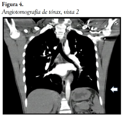 La importancia de la presunción clínica en el diagnóstico de ...