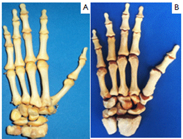 Protocolo de osteotecnia aplicado a manos humanas