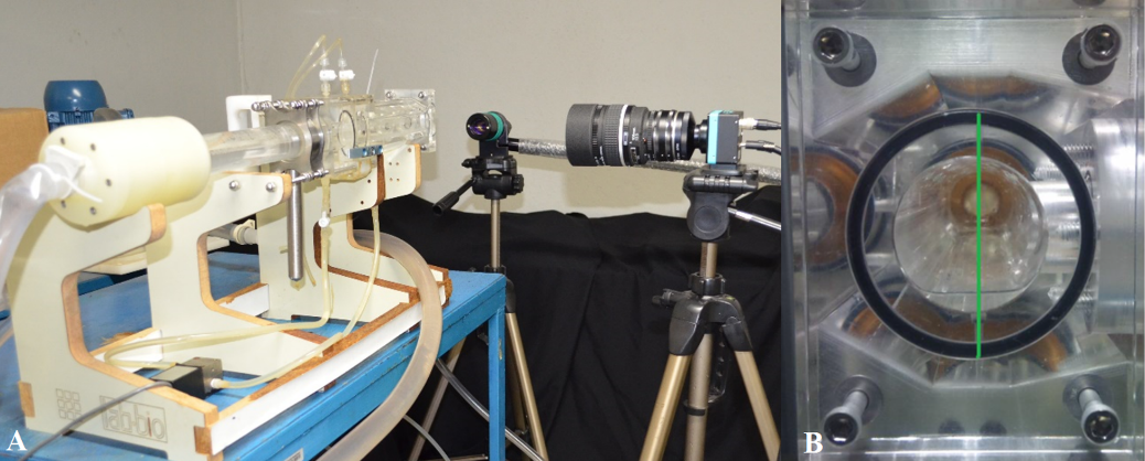 Analysis of leaflet flutter in biological prosthetic heart valves using ...