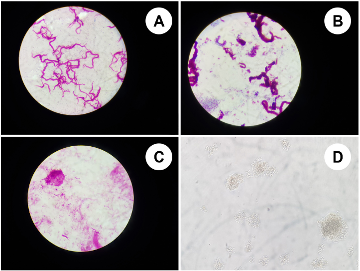 Identificación de la formación de cordones de Mycobacterium kansassi e ...