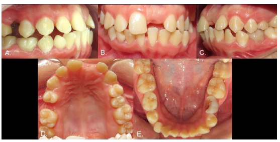 Canine Transmigration: Seven Case Reports