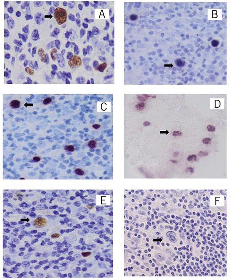 Comparative study of five commercial probes for the detection of ...