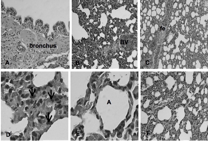 Effect of Ischemic Postconditioning and Atorvastatin in the Prevention ...