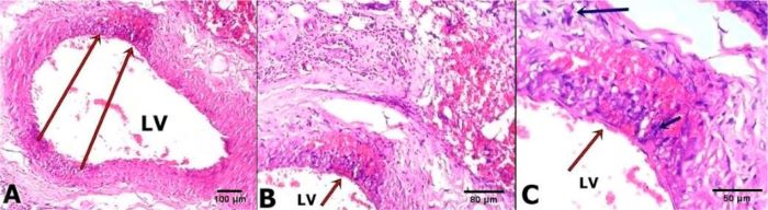 Experimental Evaluation of Chitosan Membrane and Collagen Sponge ...