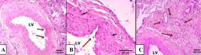 Experimental Evaluation of Chitosan Membrane and Collagen Sponge ...