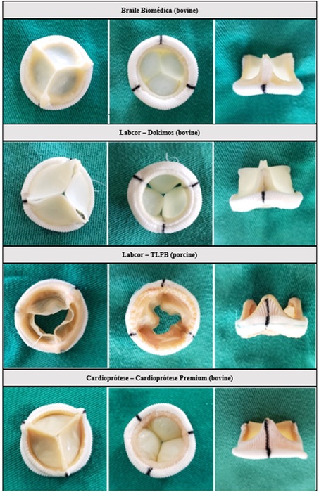 Ring Fracture of Brazilian Aortic Valve Bioprostheses Using Non ...