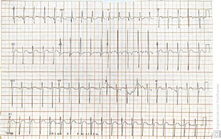 Abernethy Malformation: Possible Diagnosis for Patients with Congenital ...