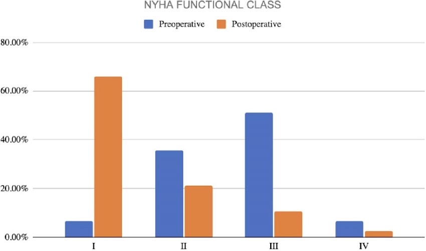 Surgical Treatment of Constrictive Pericarditis