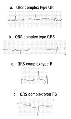 Standardizing electrocardiographic and arterial pressure parameters in ...