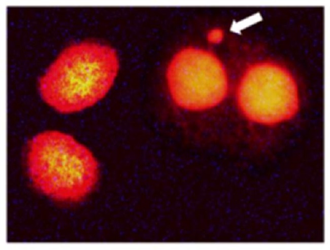 Impacts of RF radiation from mobile phones on human health and its remedies