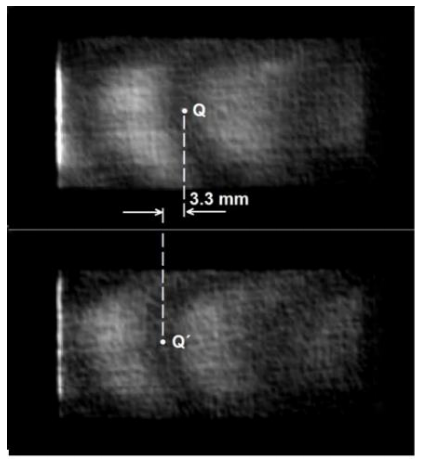 Vibration measurement by projection of phase-modulated and amplitude ...