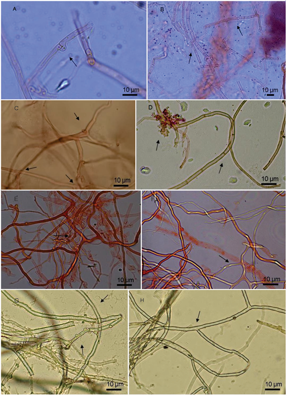 Evaluation of mycelium composite materials produced by five Patagonian ...