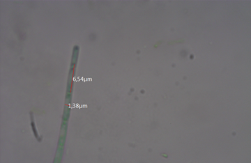 Primer registro de Limnothrix vacuolifera y Limnothrix planktonica ...