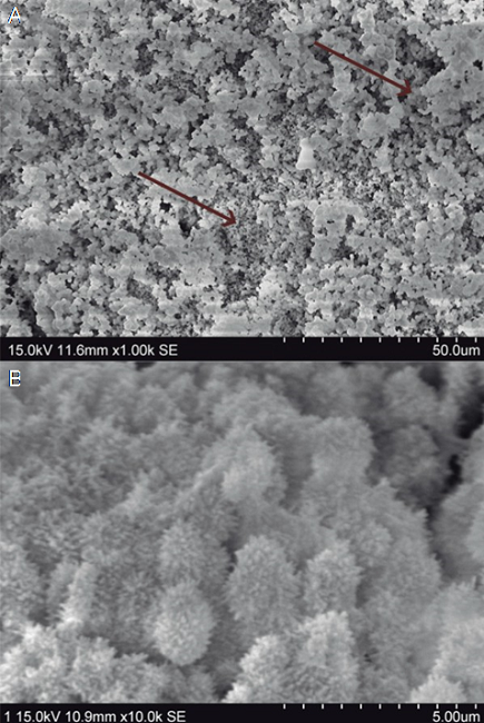 Ex Vivo Analysis of MTA FLOW® Biomineralization and Push-Out Strength ...