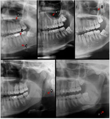 Impact of Different Evaluation Methods for Diagnostic Tasks in ...