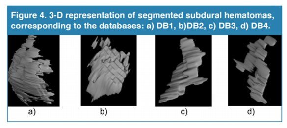Volumetry of subdural hematomas in computed tomography images: ABC methods versus an intelligent ...