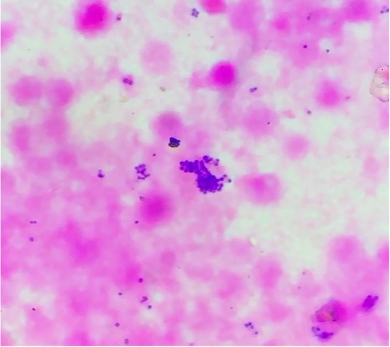 Staphylococcus Epidermidis Gram Stain