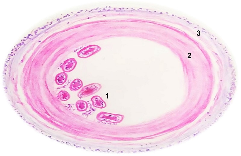 Hydatid cyst involving the mandible ramus