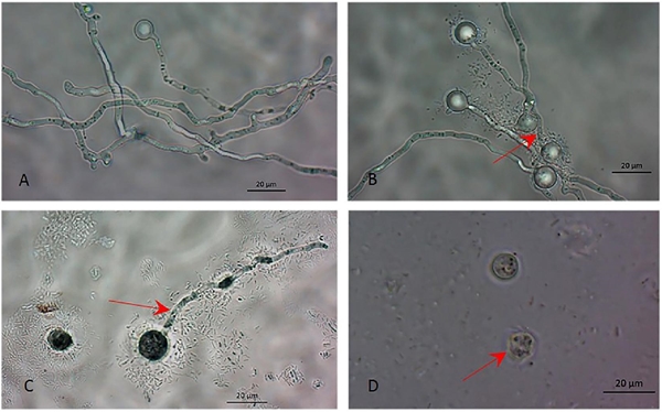 Efecto de biocontrol e inhibición germinativa de Bacillus spp. sobre ...