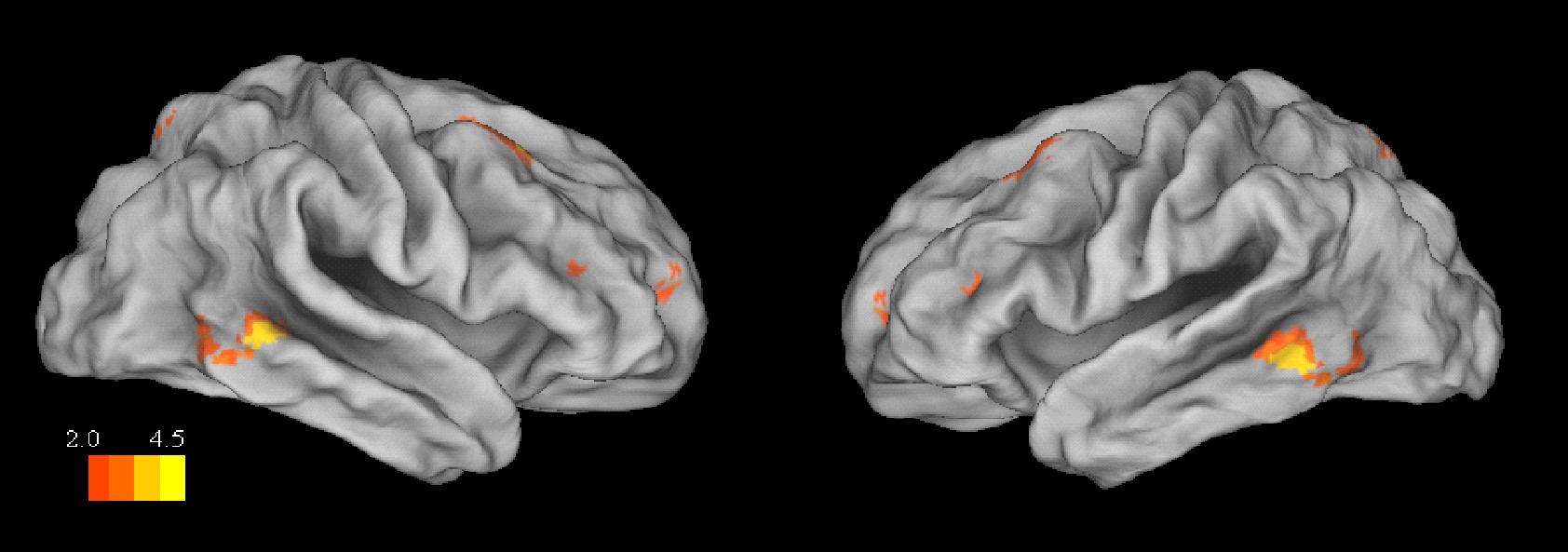Developing a Social Cognition Task for fMRI in Patients with Mild ...