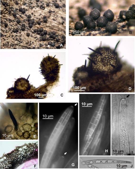 Micromycetes on bark and wood of Podocarpus parlatorei (Podocarpaceae ...
