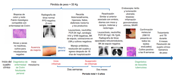 Tuberculosis asociada a antagonistas del factor de necrosis tumoral ...