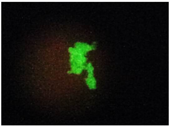 The conventional diagnosis challenge: Real-time PCR and nested PCR ...