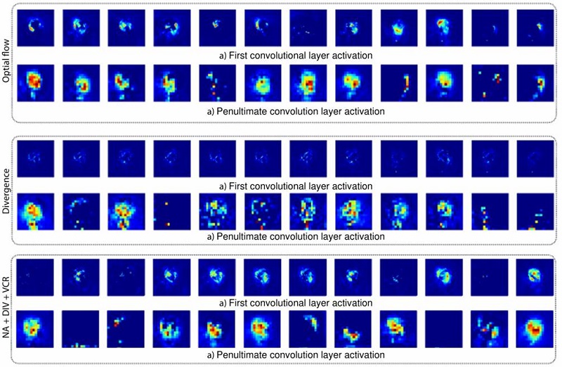 Cardiac disease discrimination from 3D-convolutional kinematic patterns on cine-MRI sequences